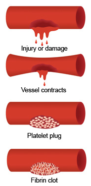 Inherited bleeding disorders - eLearning Platform
